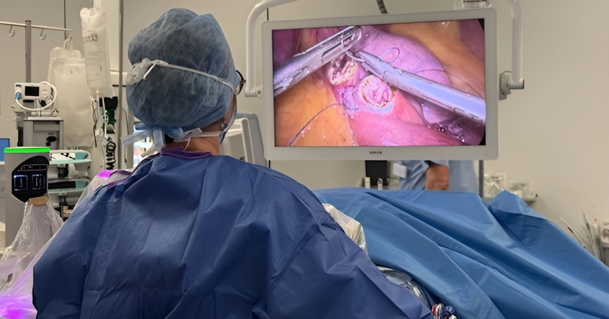 Comparaison entre sleeve et bypass gastrique à Bruxelles